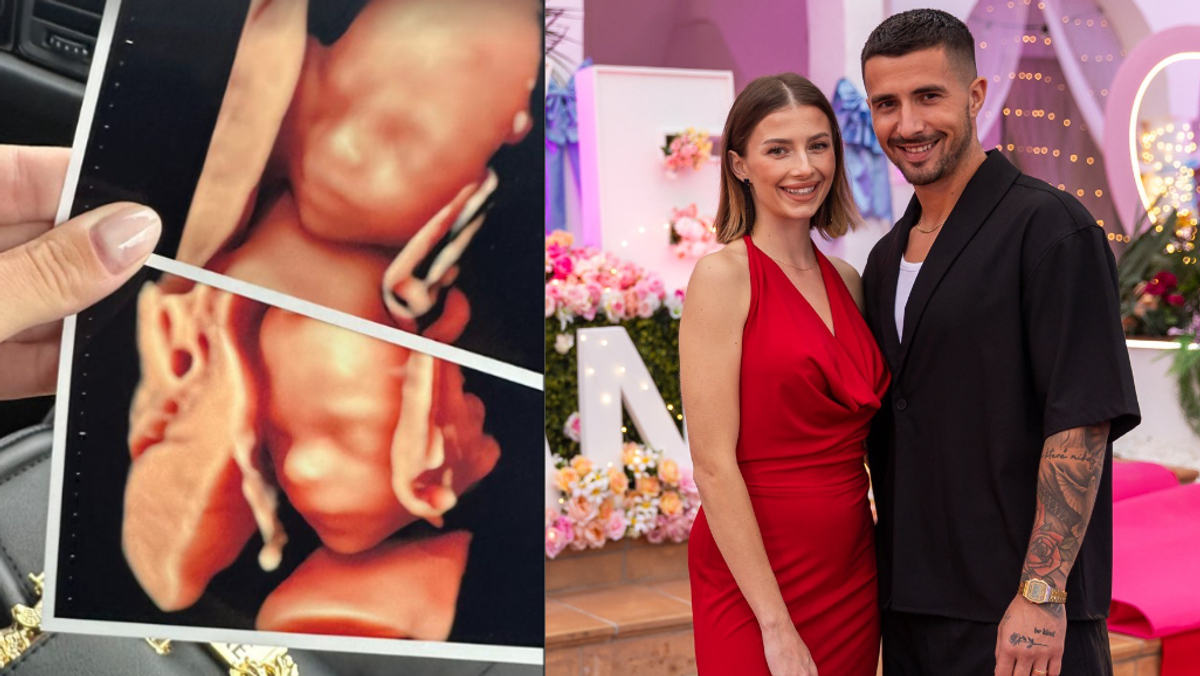 Komu je podobné? Laura z Love Islandu ukázala fotku svého miminka | TV Nova