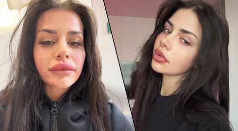 Velká proměna Domi Alagii: Přiznala nečekanou kosmetickou úpravu | TV Nova